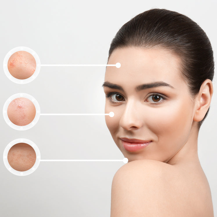 One-day Acne Scar Treatment Package - Jivaka Beauty